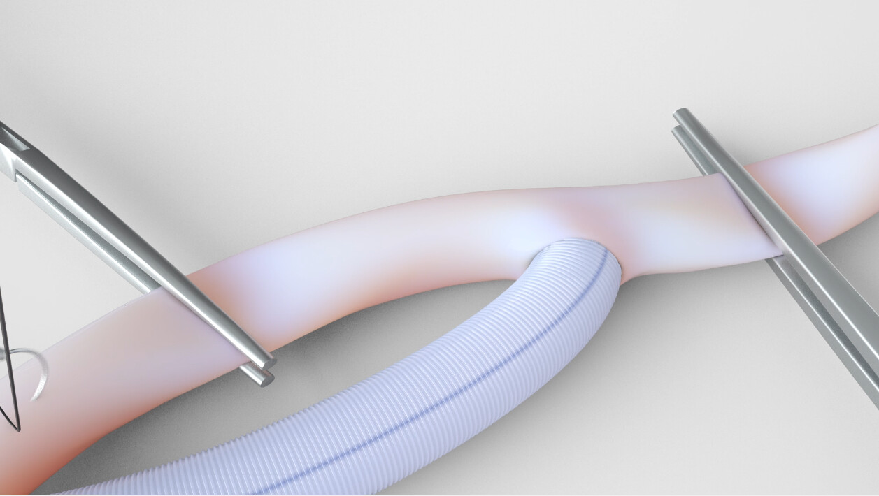 ArtStation - Vein implant