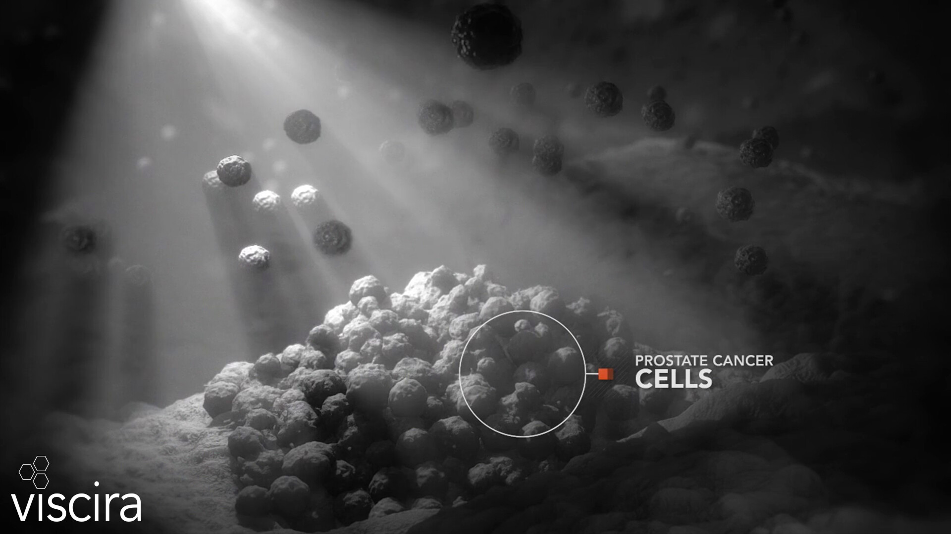 ArtStation - "Prostate Cancer" Medical Animation.