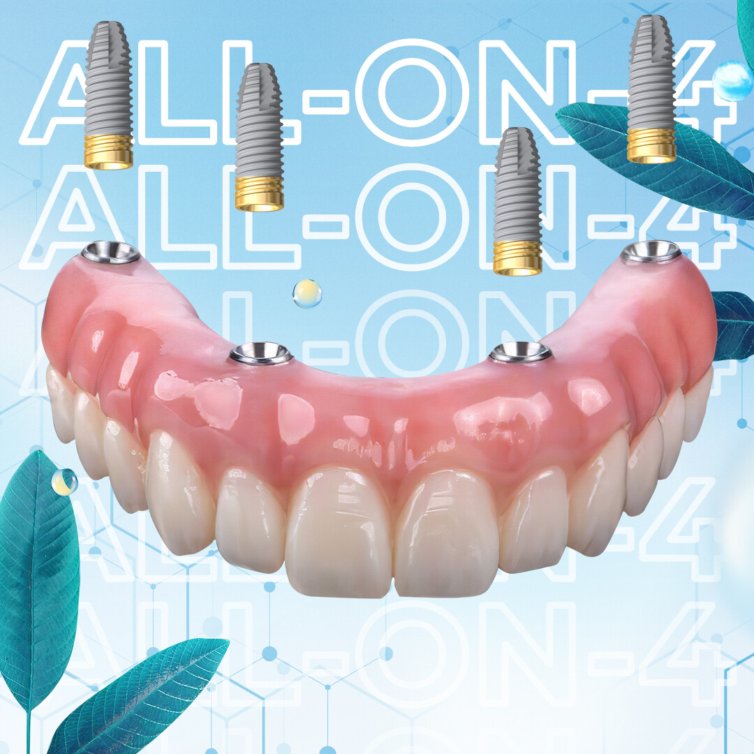 ArtStation - YANCreatives-BIGsmile