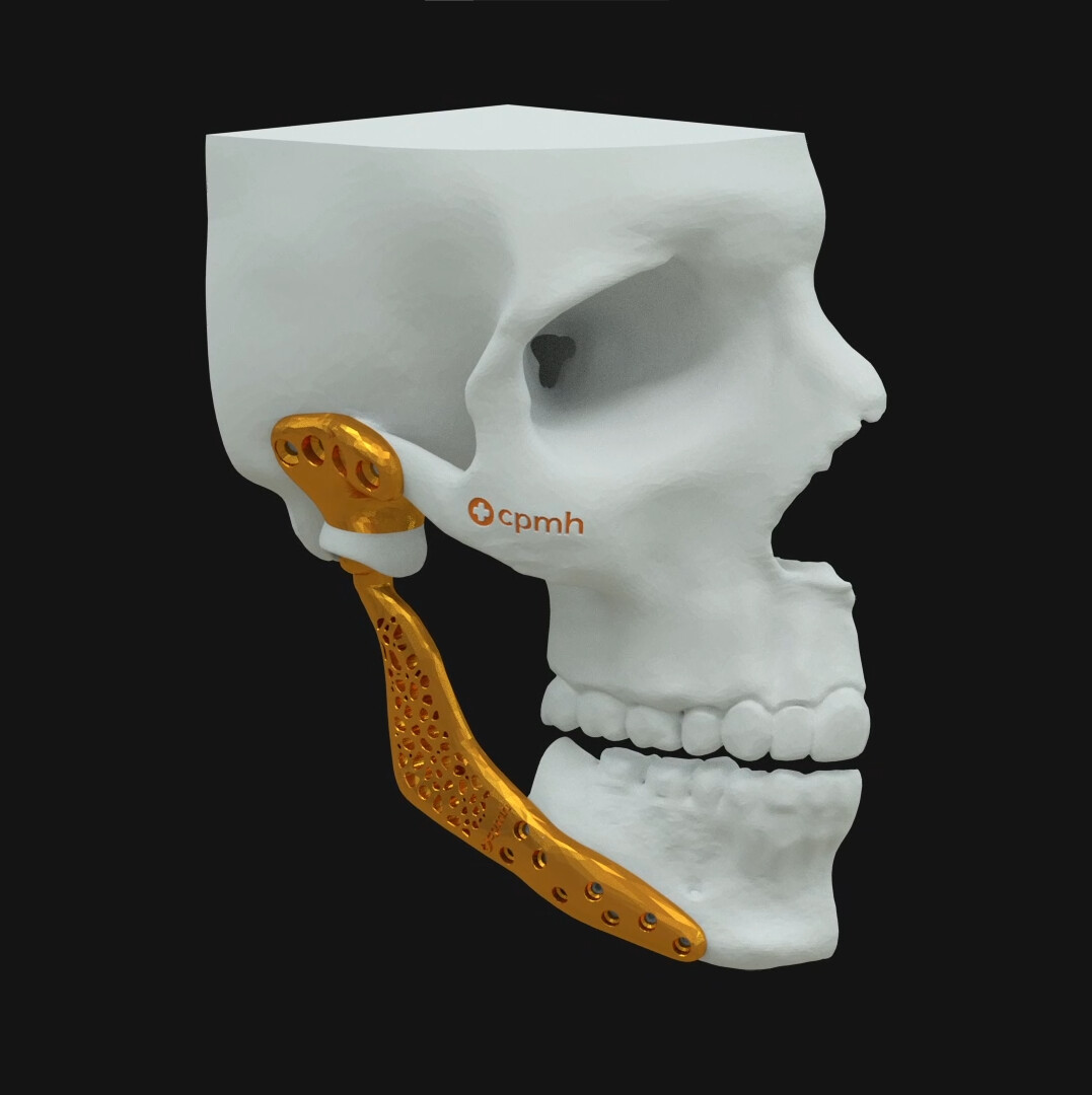 ArtStation - Trabecular TMJ Reconstruction Animation