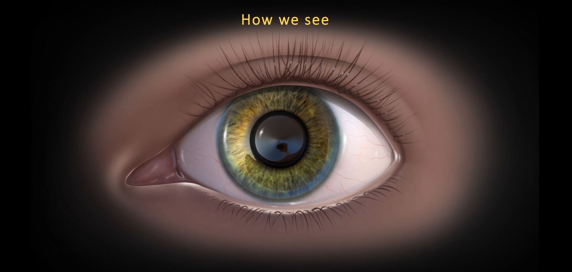 ArtStation - Eye Medical Animation