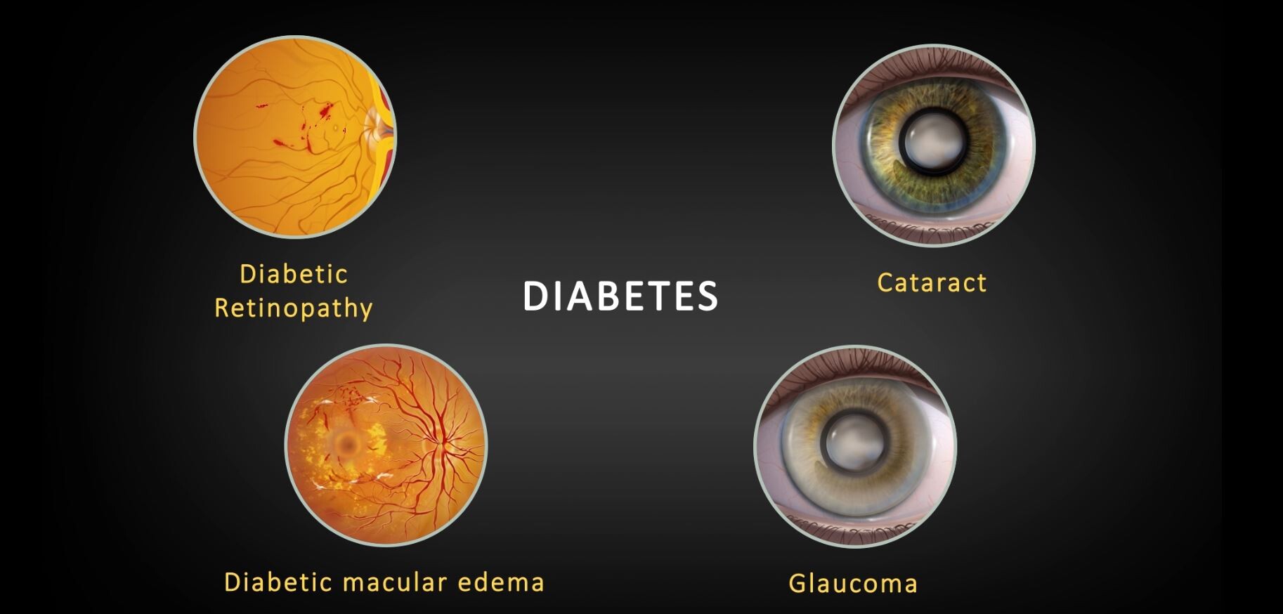 ArtStation - Eye Medical Animation