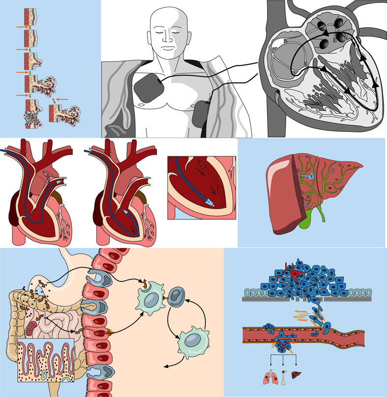 ArtStation - medical illustrations