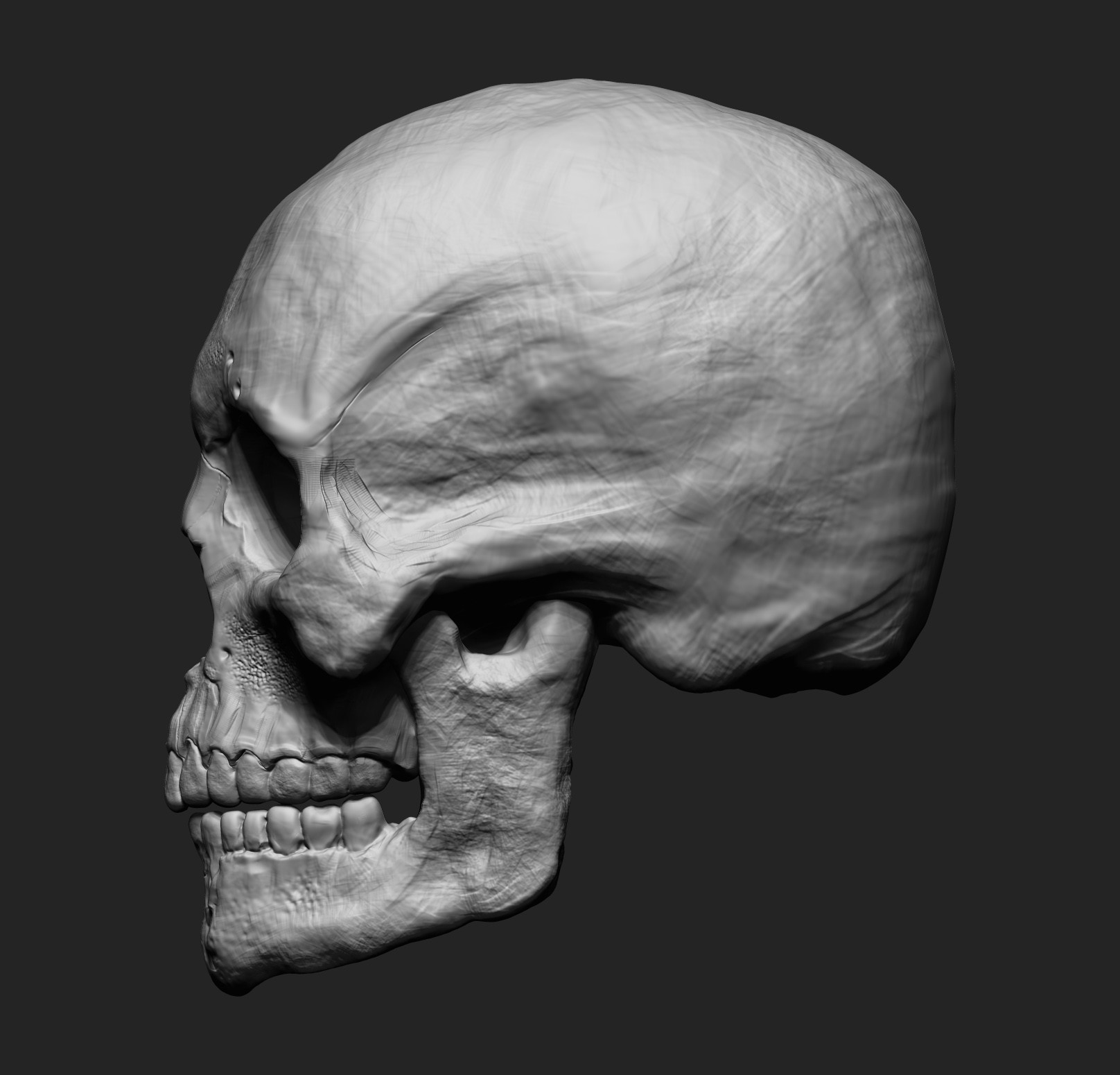 monogloid skull