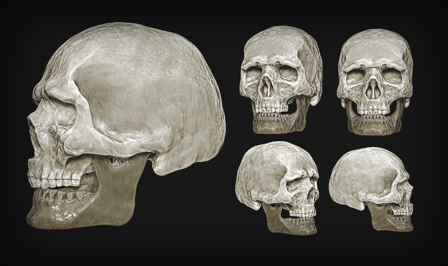 Praphul P Ambika - Scull Study