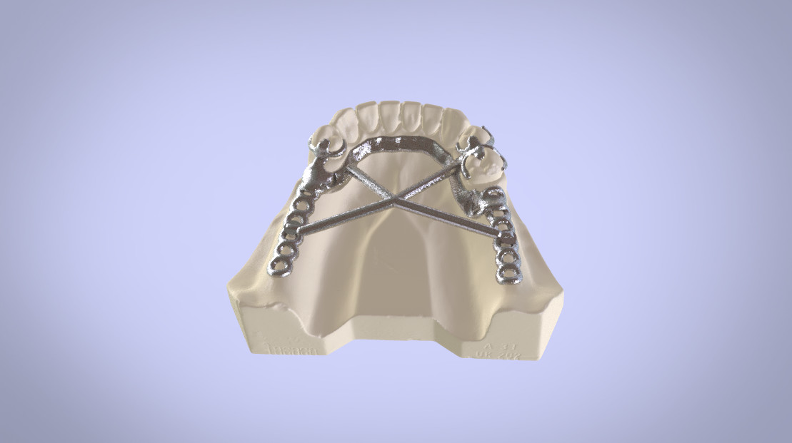 LabMagic 3D DentCAD - Digital 3D Removable Partial Denture