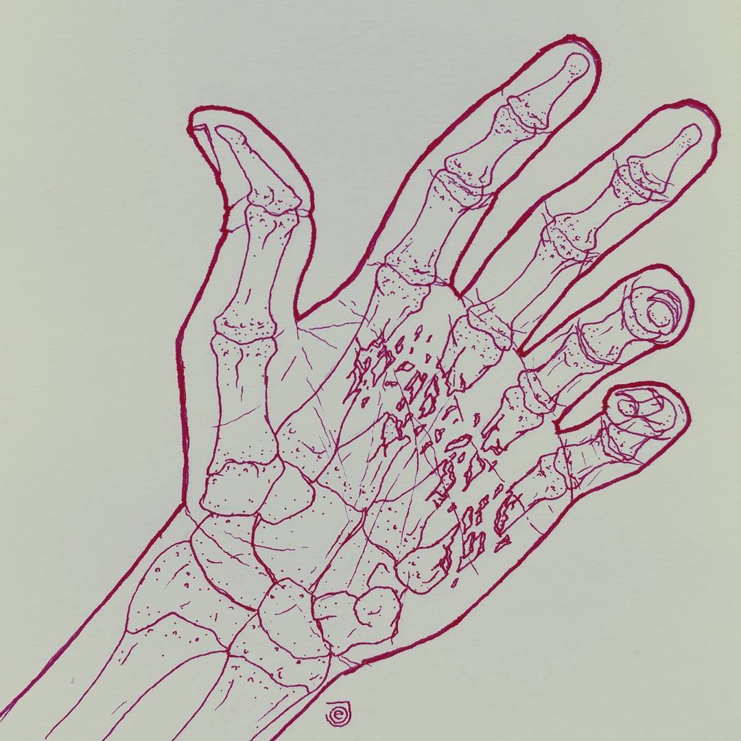 Joe Dead - Shattered Hand