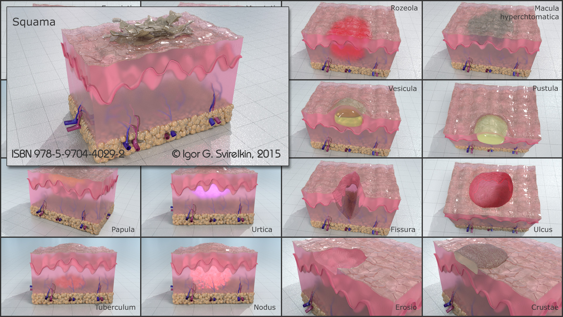 Igor Svirelkin - Morphological elements of skin rash
