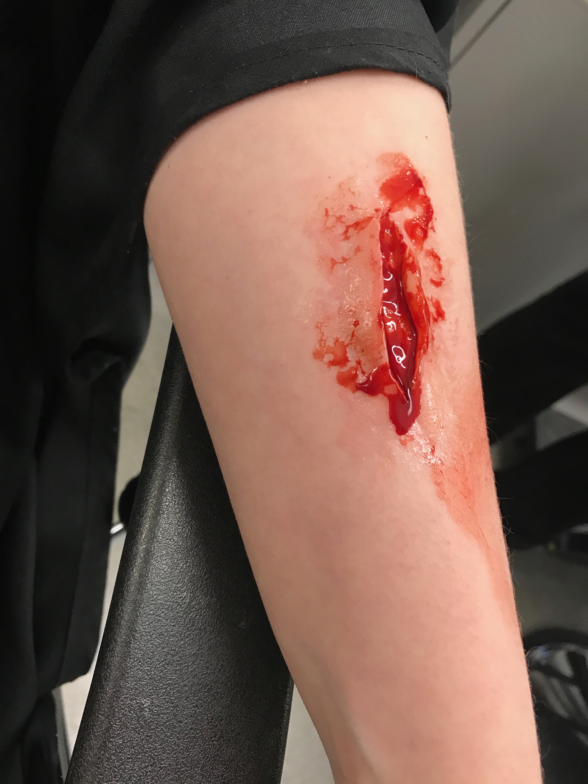 cut on arm small