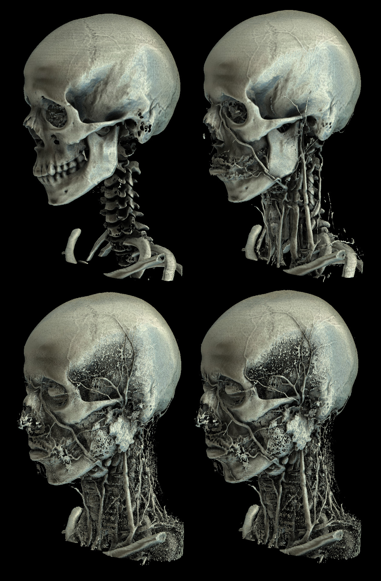 human skull volume