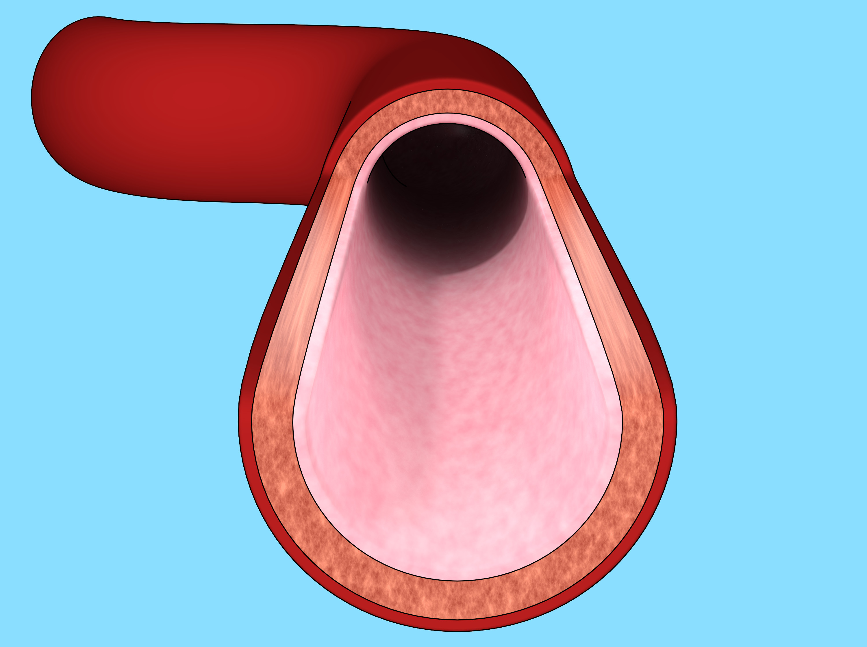 Donald Backos Artstation Portfolio - Vascular Surgery Scoring Sheet