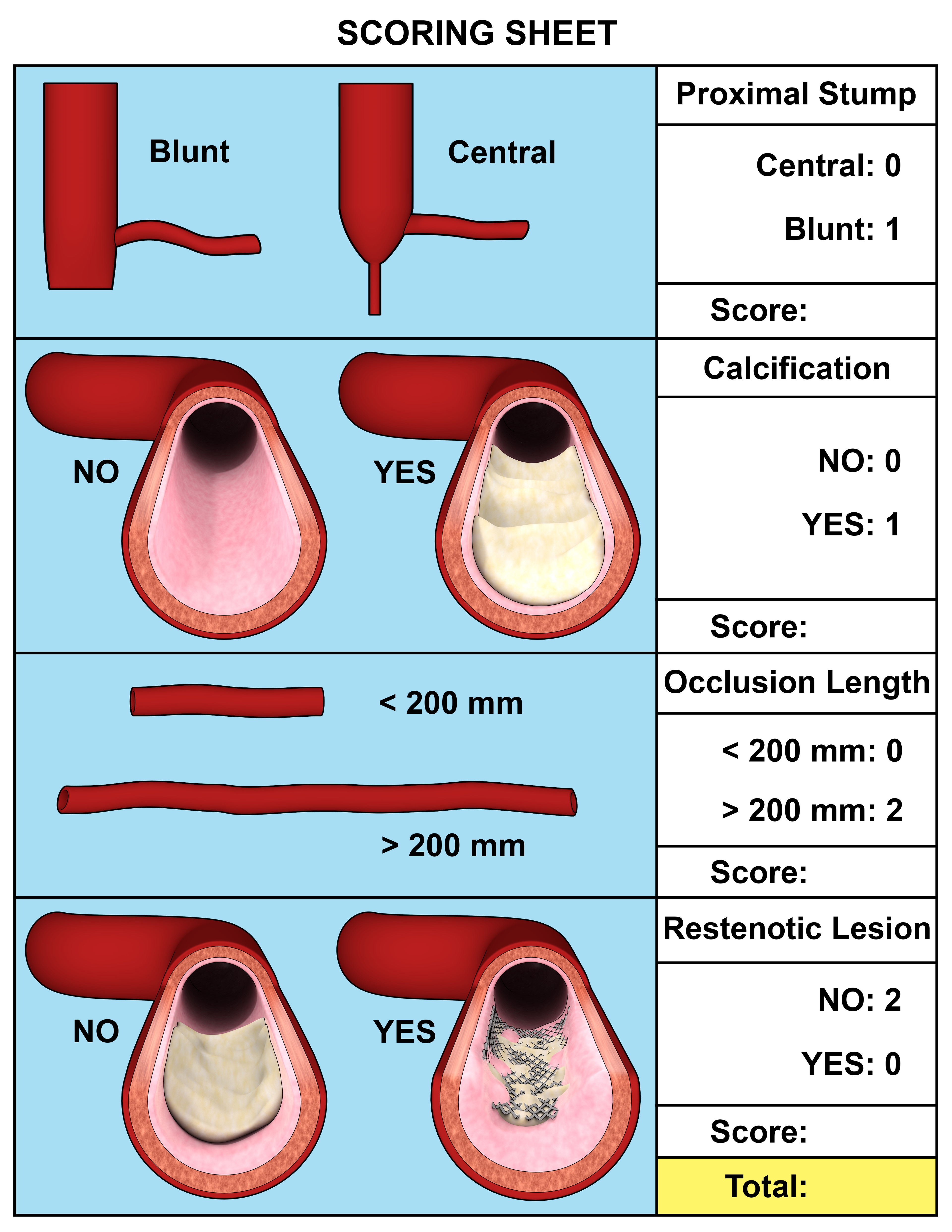 Donald Backos Artstation Portfolio - Vascular Surgery Scoring Sheet