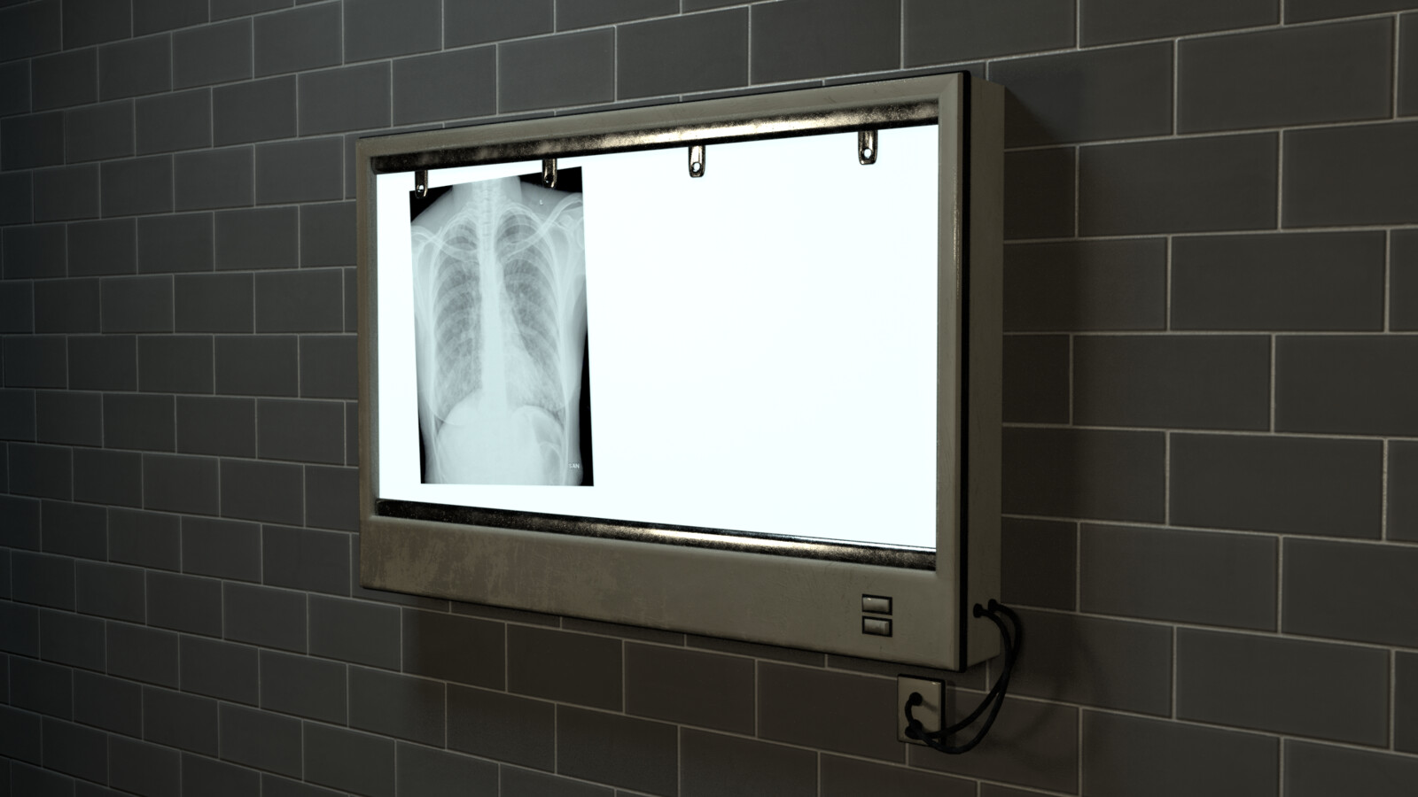 Mr. Eye - X-Ray Viewer