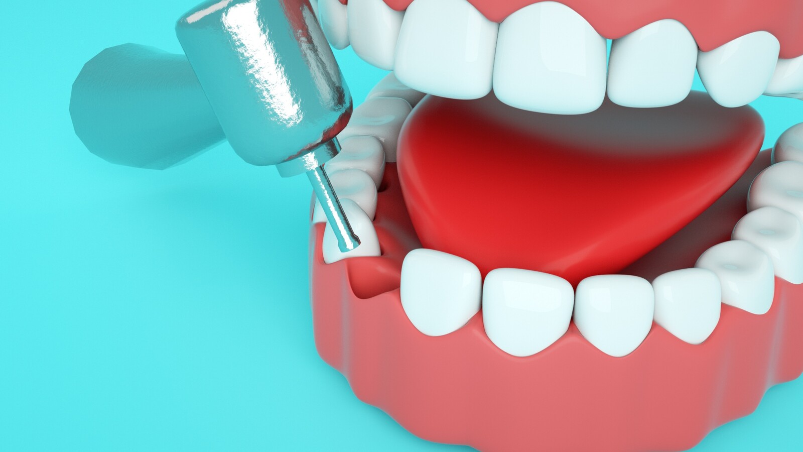 Alan Kichl - Dental animation
