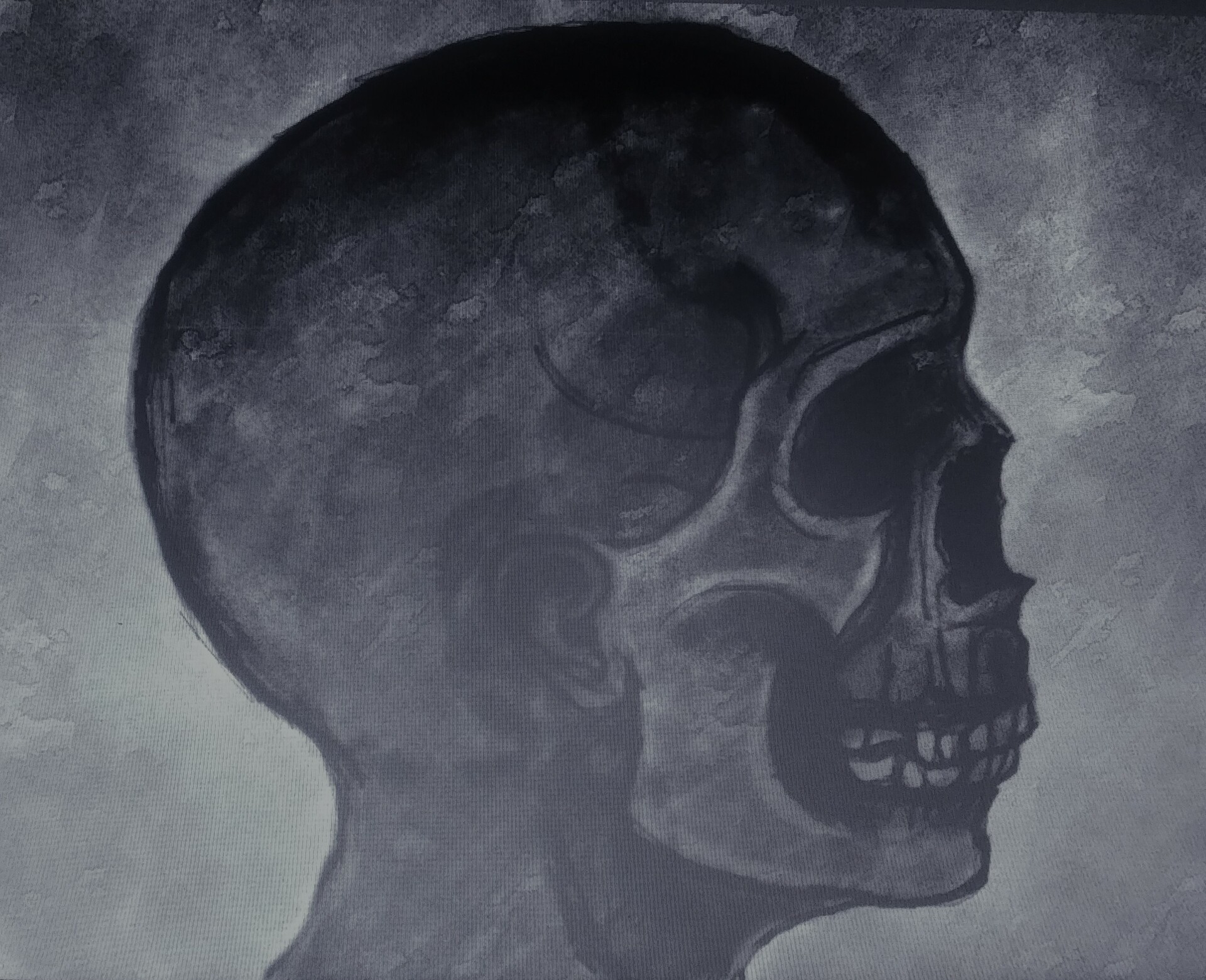 ArtStation - Walking corpse