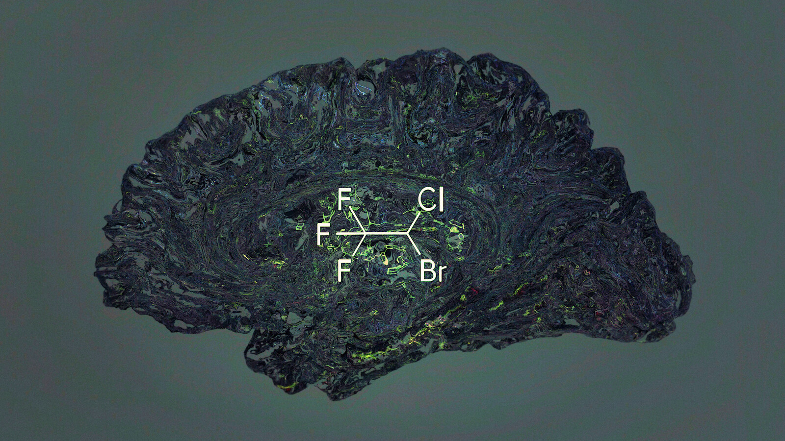C K - Our Chemistry - Anesthesia