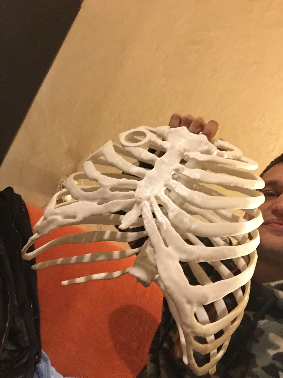 Petar Valchanov - Cardiosurgery training simulator - the hypersthenic chest