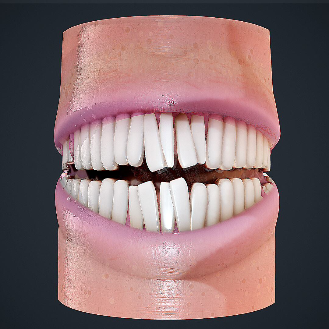 Thomas Meurisse - Crooked teeth