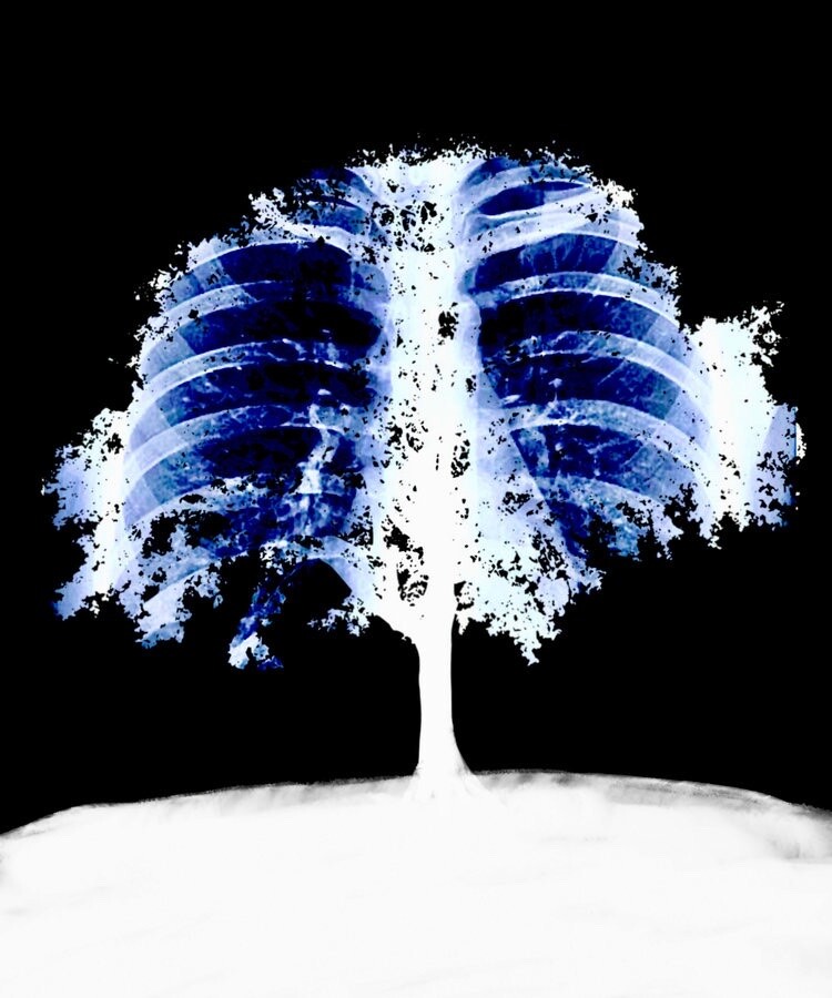 ArtStation - Skeleton/tree