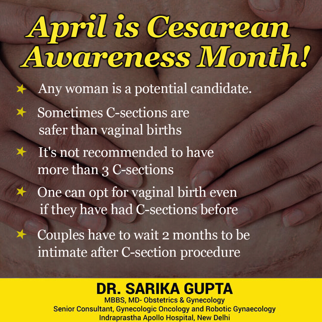 ArtStation - post design