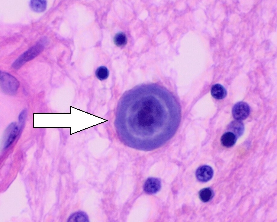 bezada - SCP-4923 = '' Corpora Arenacea''