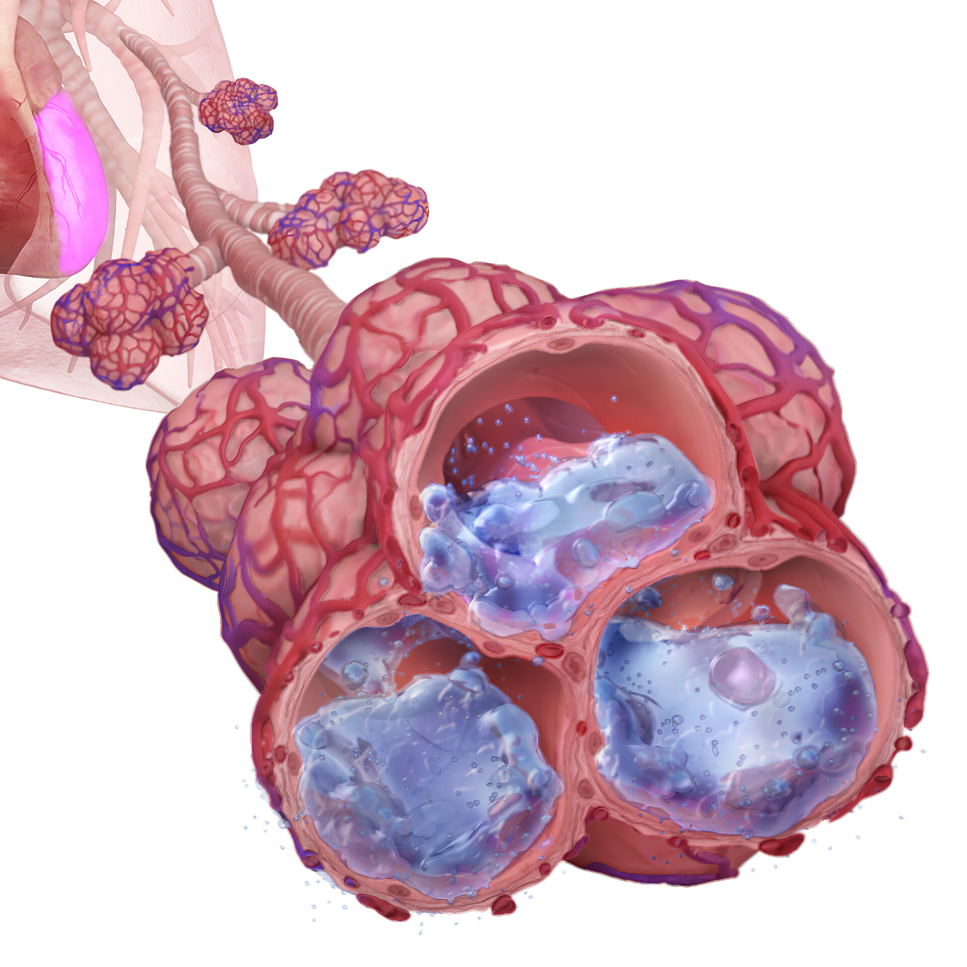 Joe Samson - Heart Failure Illustrations