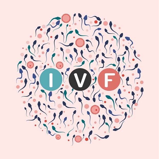 ArtStation - IVF Art