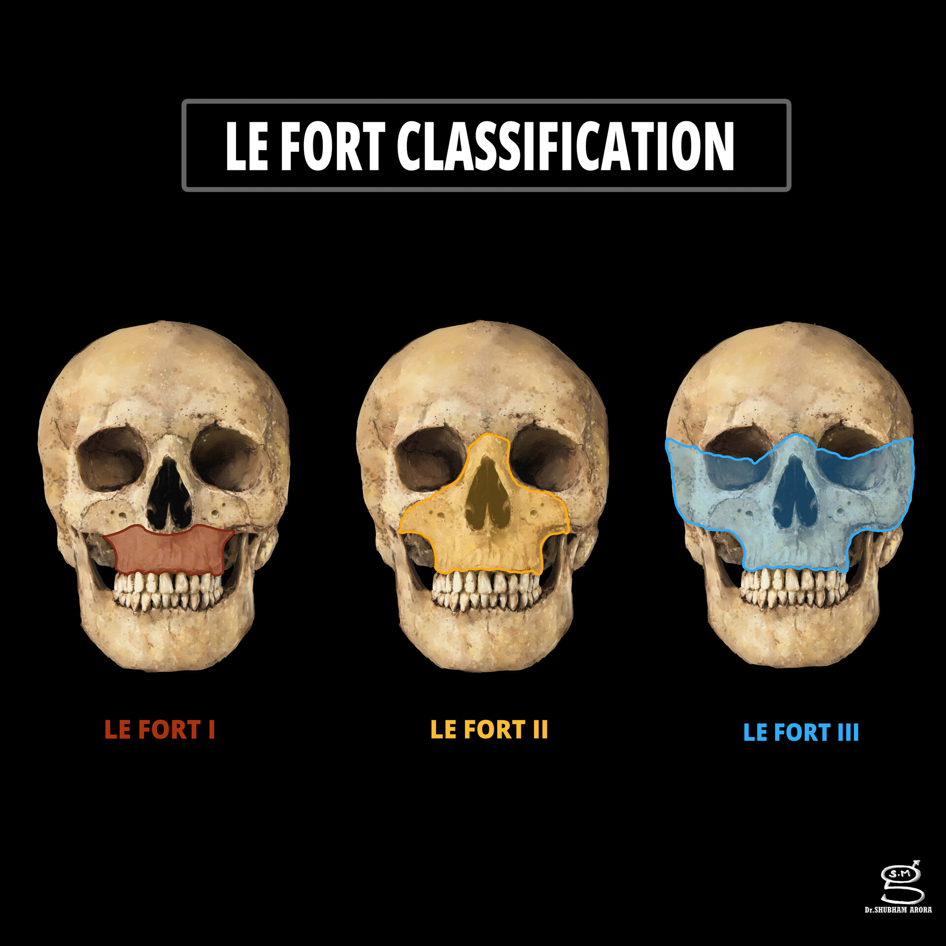 ArtStation - Le fort classification illustration