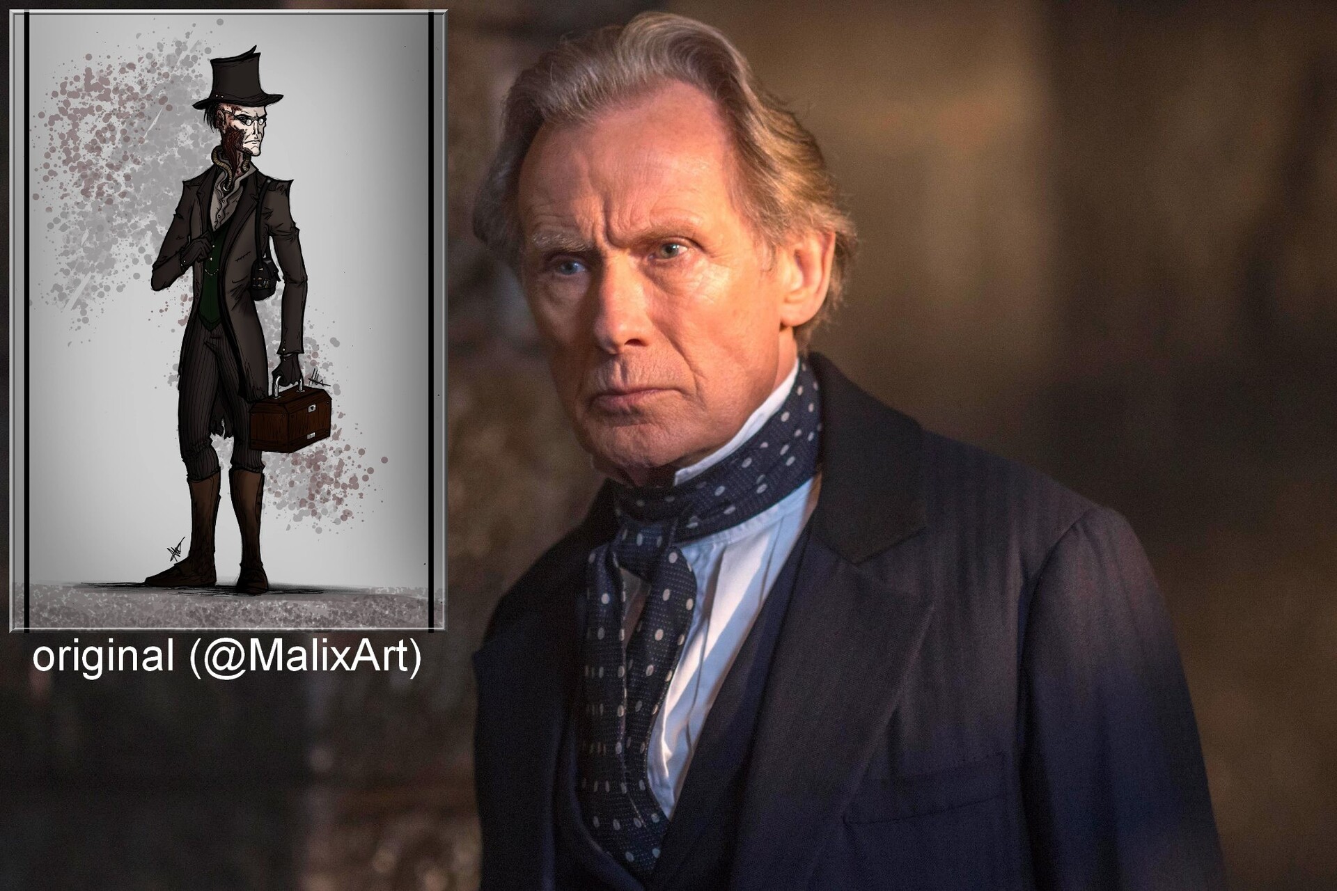 Emile Fischer - Dr Edgar (Bill Nighy) - 2021