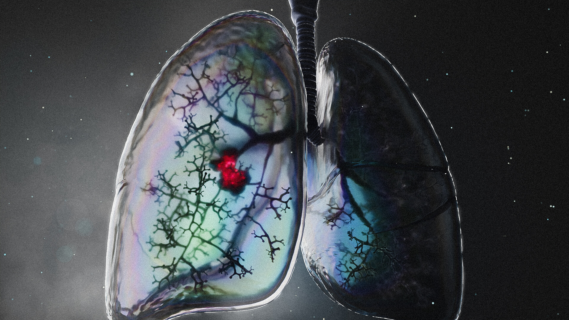 Brad Krajina Scientific Visualization - Tumor Growth Animation