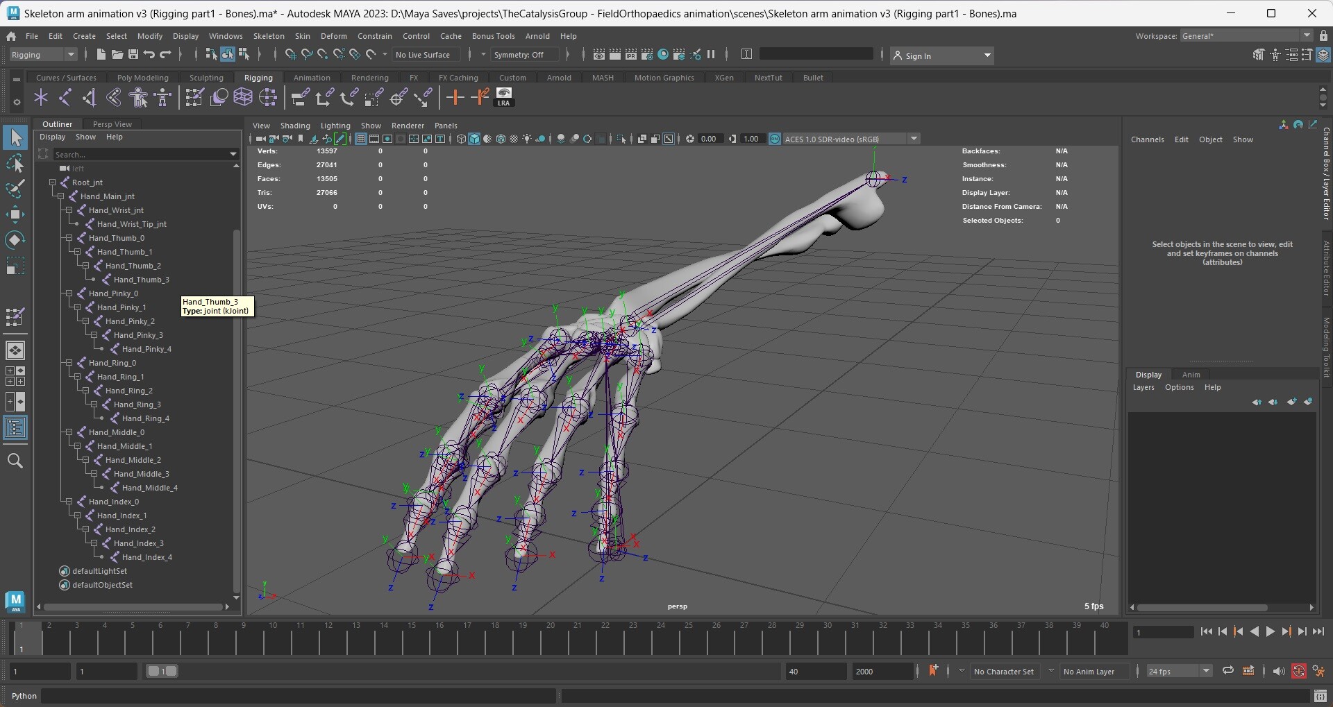 Miklos Lissa - Surgical Tools and Surgical Techniques on Skeleton Arm