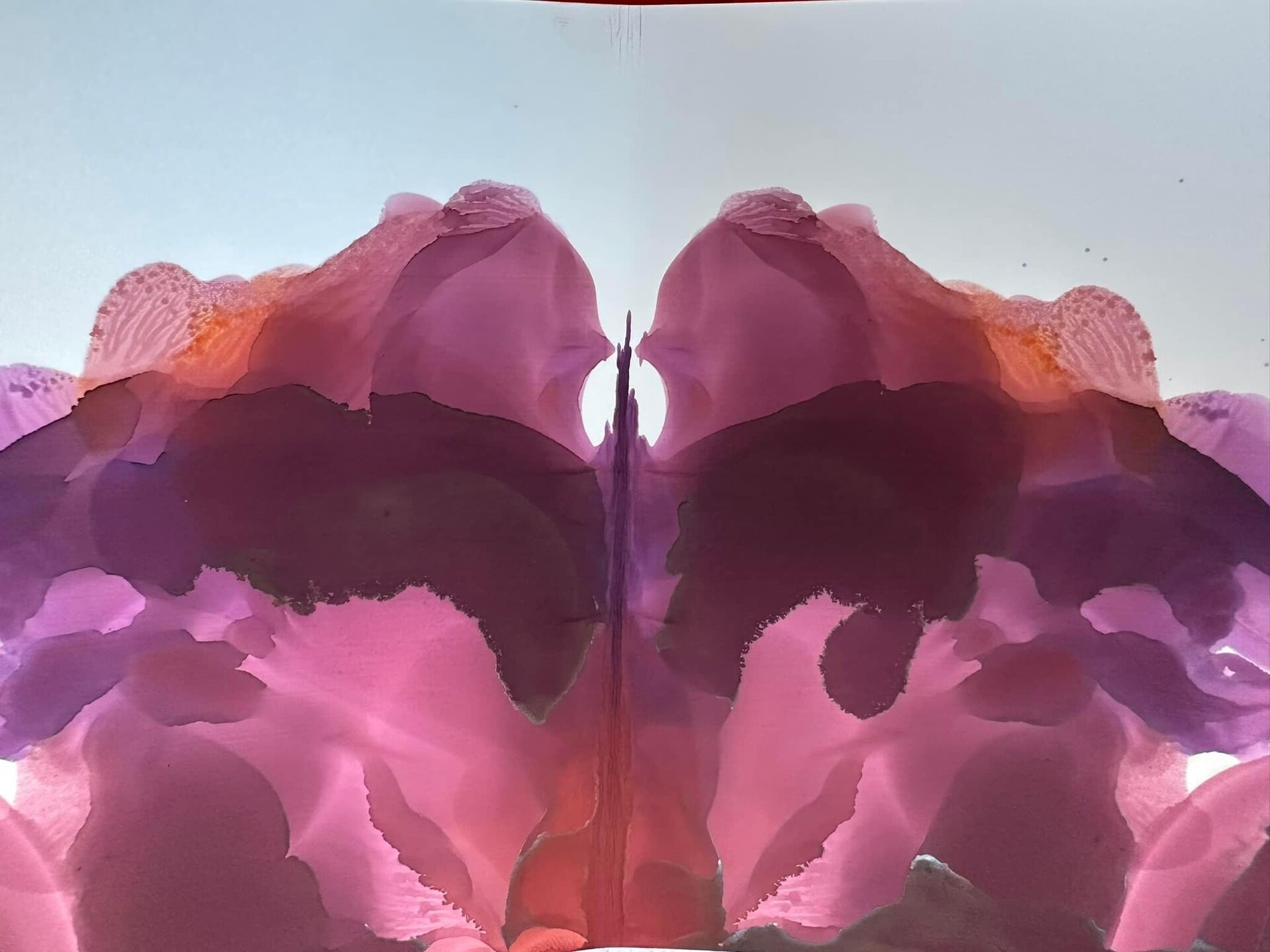 ArtStation - Open- Heart Surgery