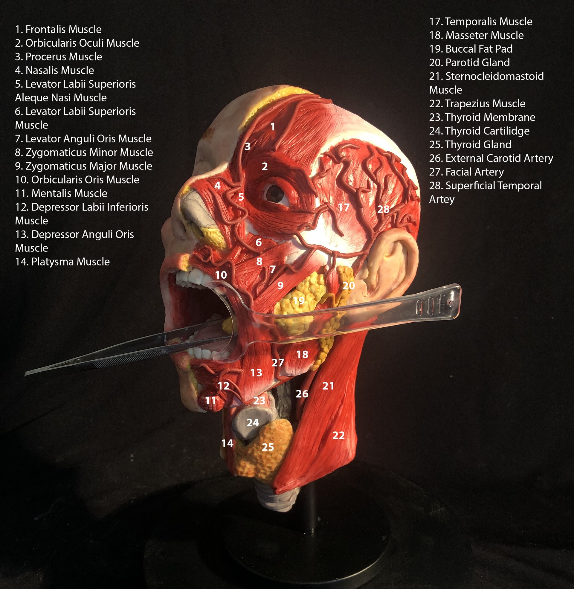 ArtStation - Labelled Buccal Fat Removal Wax Écorché Sculpture