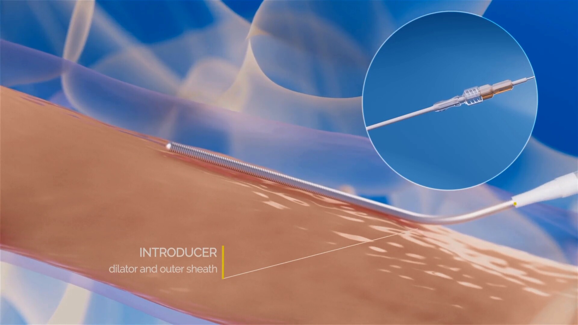 ArtStation - Animation project for WISE S.r.l.