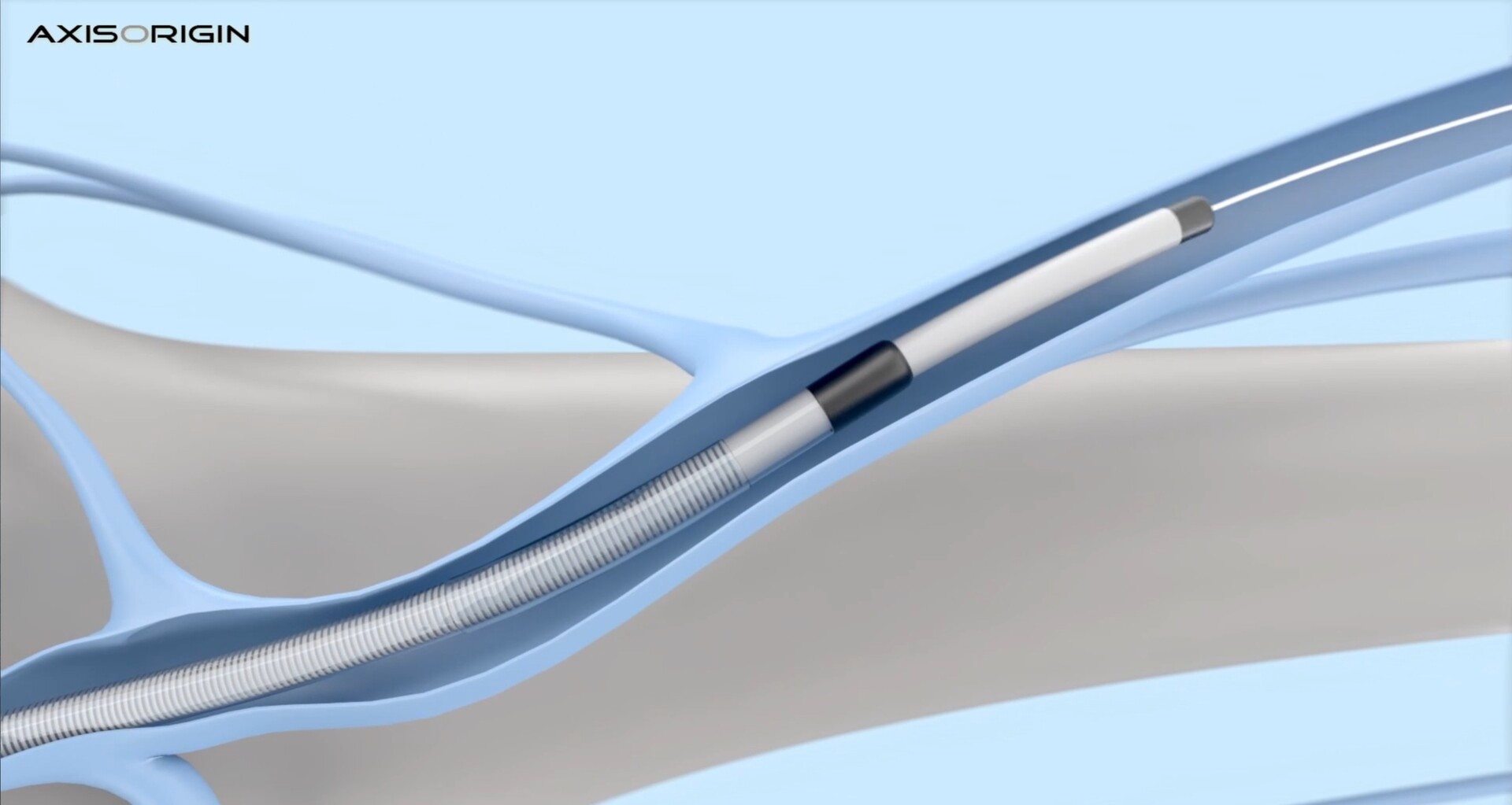 Lars Minsaas - Catheter Device Animation Part 02 - Maya, Modo