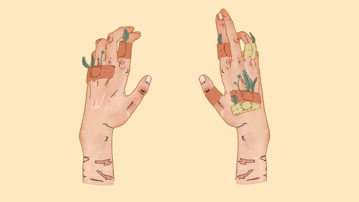 ArtStation - Damaged hands