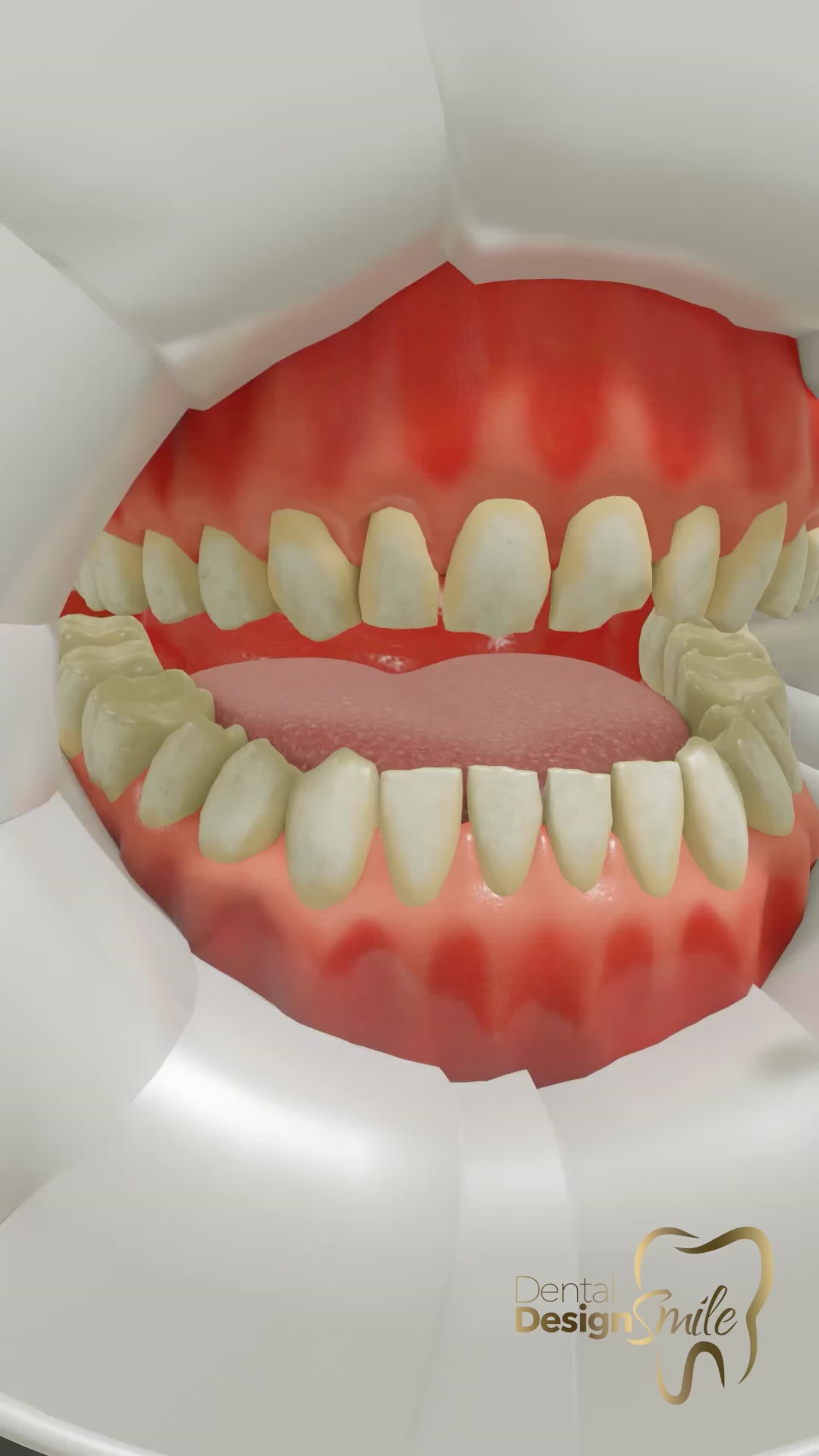 ArtStation - Advertising animation "dental veneers"