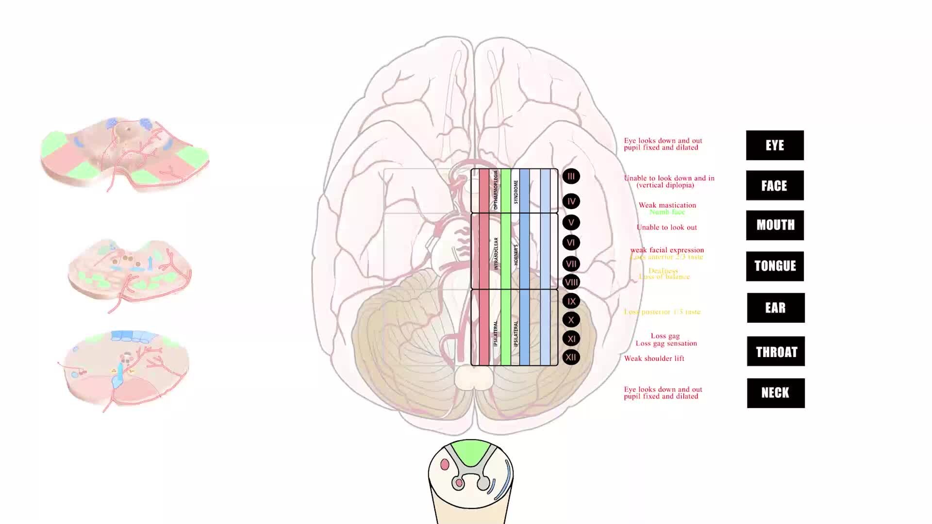 ArtStation - Cranial Nerves and its defect overview
