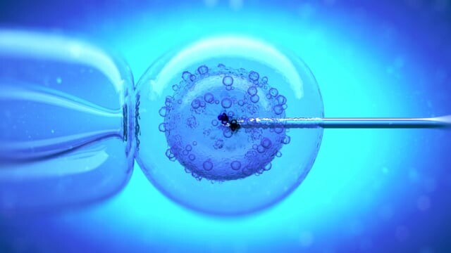 ArtStation - Injection