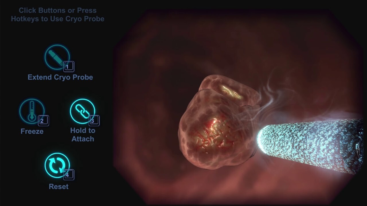 ArtStation - Mobile Platform Medical Visualization