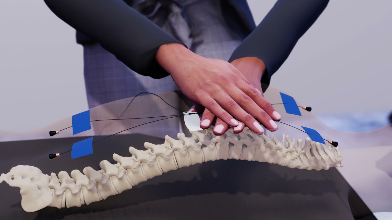 ArtStation - 3D Medical Animation