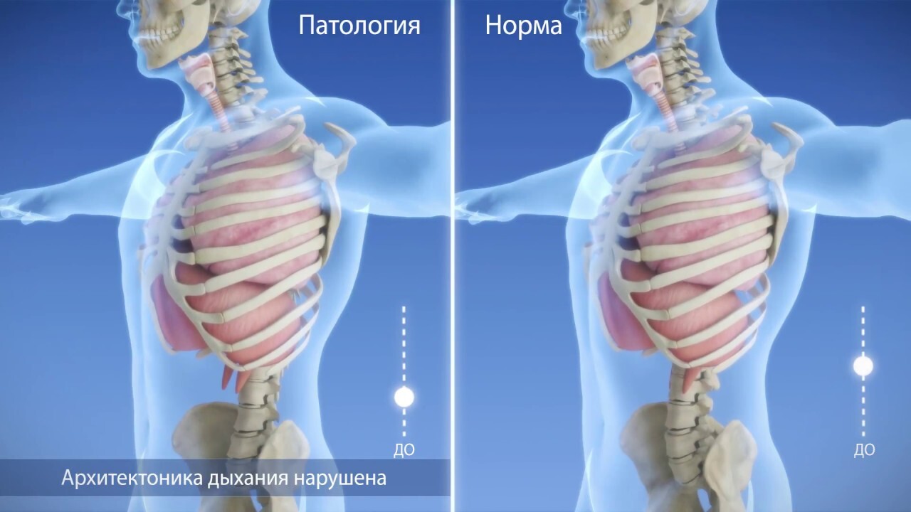ArtStation - 3D Medical Educational Animation