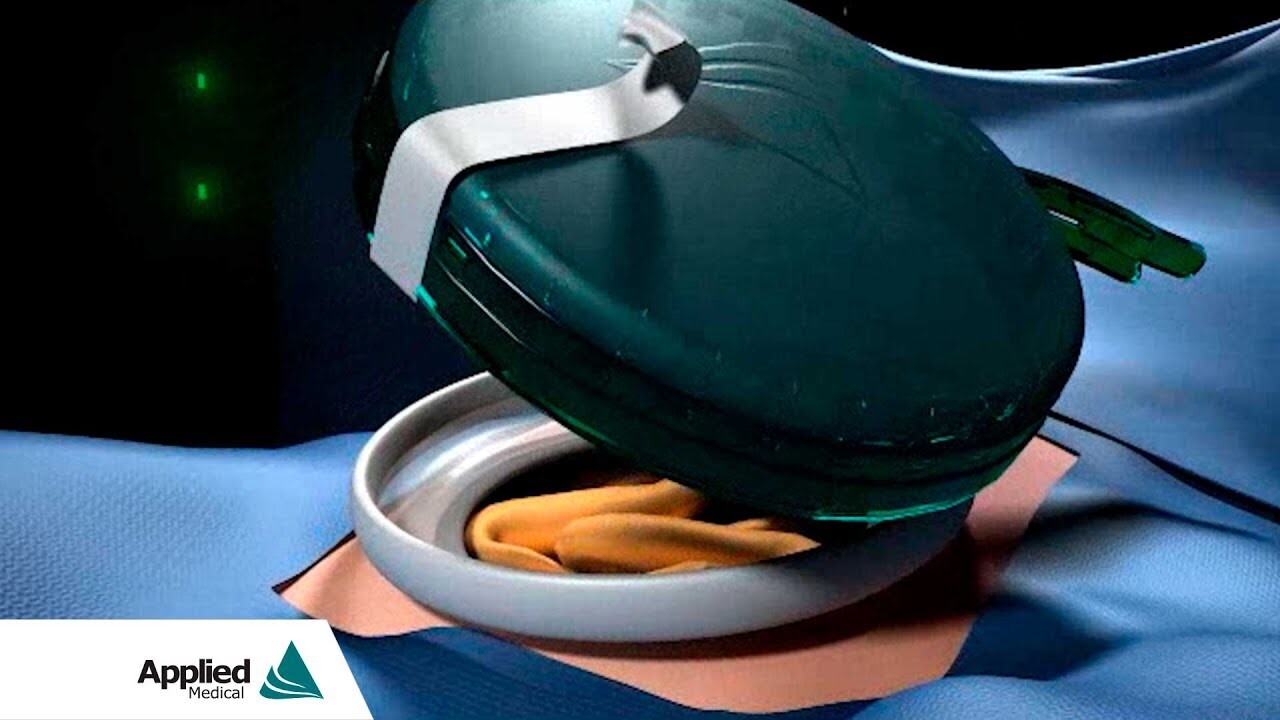 ArtStation - GelPort® Laparoscopic System Set Up Guide