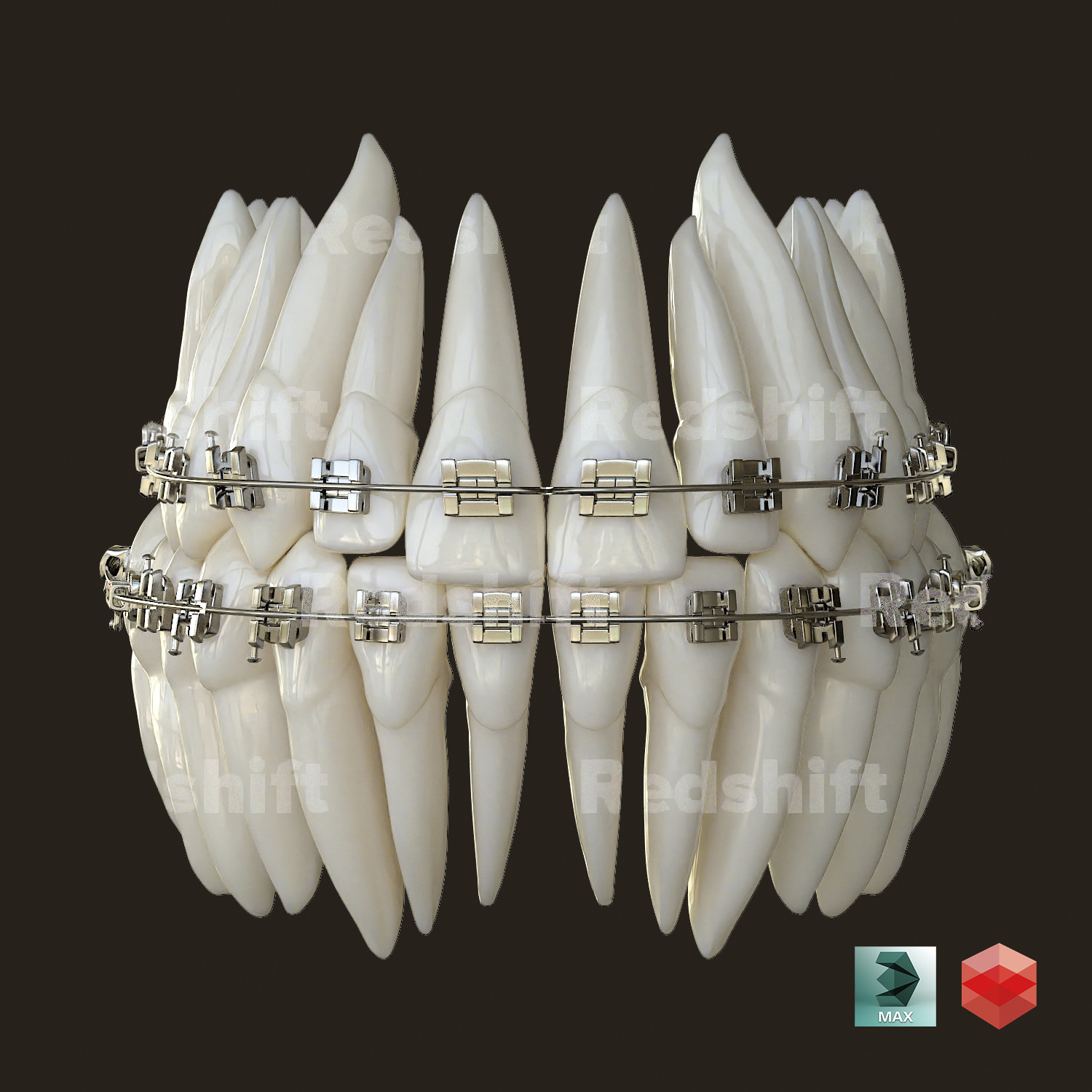 ArtStation - Teeth 3D Print and Render. | Resources