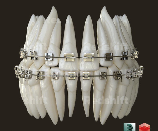 ArtStation - Teeth 3D Print and Render. | Resources