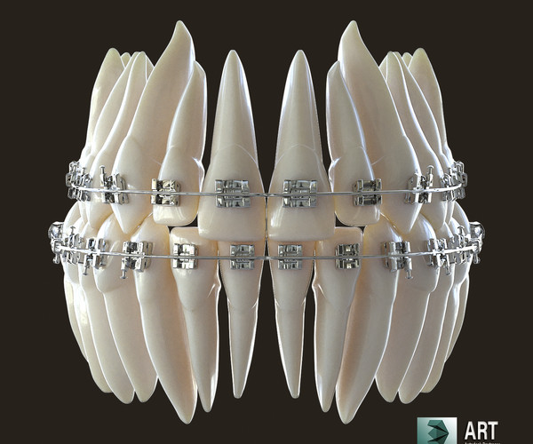 ArtStation - Teeth 3D Print and Render. | Resources