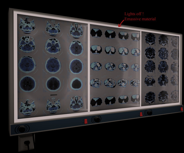 ArtStation - screen x ray film viewer | Resources