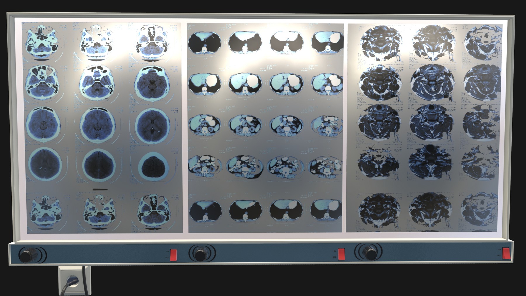 ArtStation - screen x ray film viewer | Resources