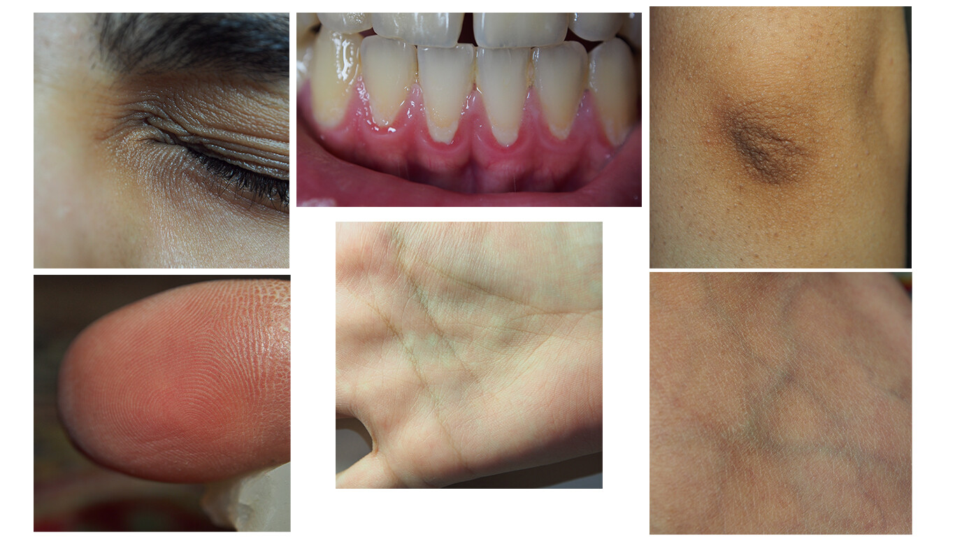 ArtStation - Super quality pack of human body skin reference images ...