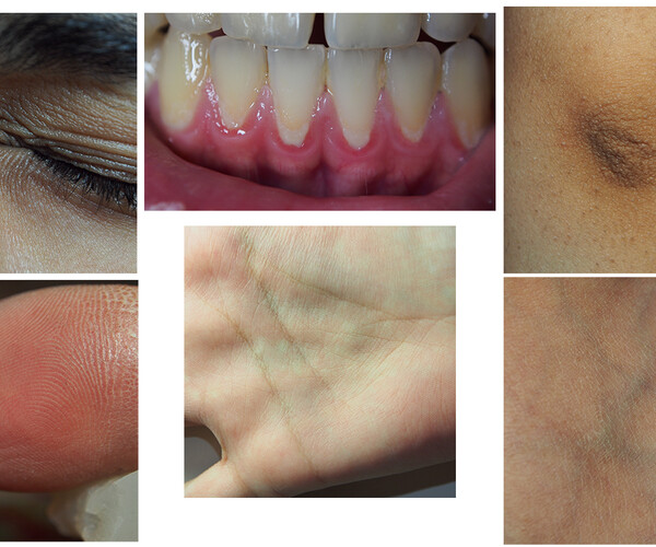 ArtStation - Super quality pack of human body skin reference images ...